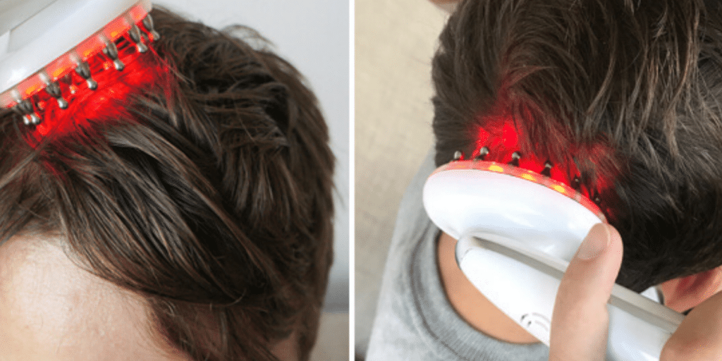 Top 5 Best Laser Combs – Customer Choice